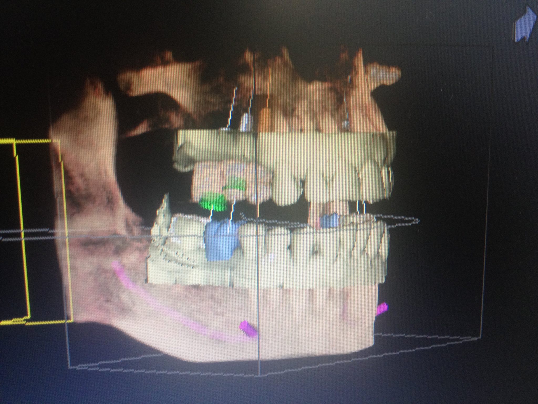 Sirona XG® 3D / Implants – Complete Dental of Mobile