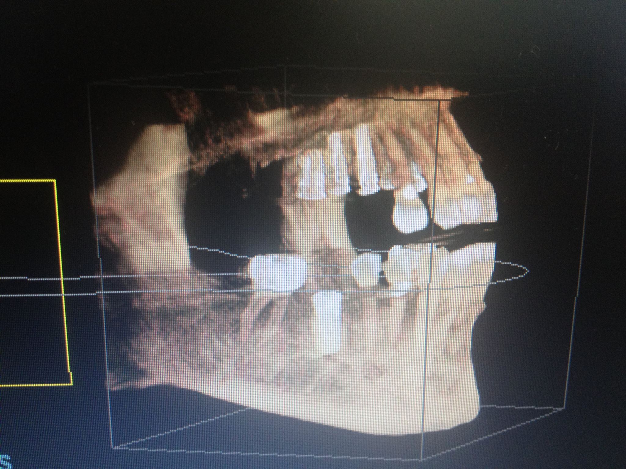 Sirona XG® 3D / Implants – Complete Dental of Mobile